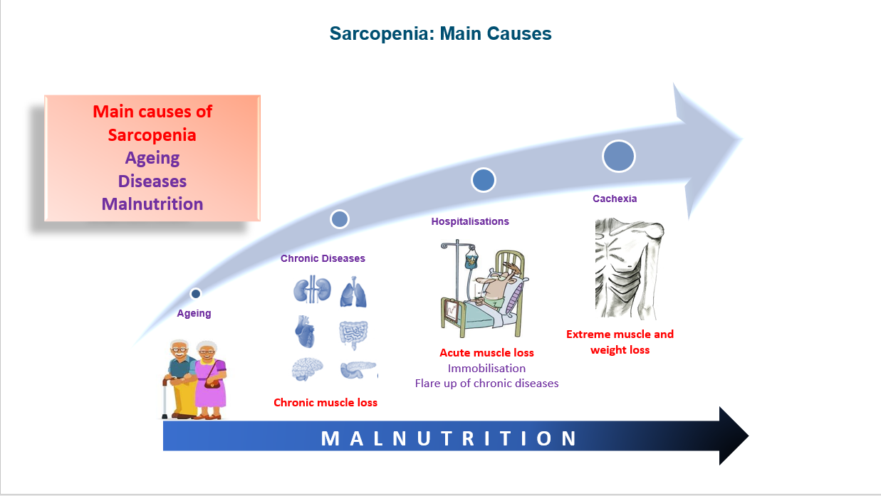 Webinar write-up: Maintaining muscle strength to reduce falls risk