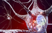 Motor neuron disease and the elderly - Pavilion Health Today