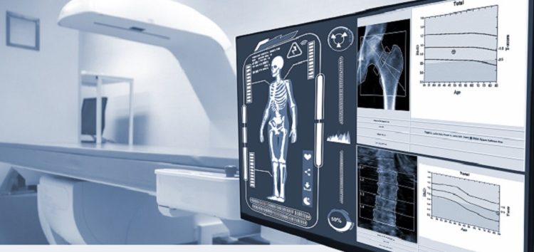 Osteoporosis - Pavilion Health Today Osteoporosis - Pavilion Health Today